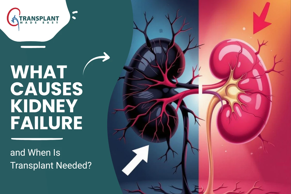 Main Causes of Kidney Failure: Types, Symptoms & Treatment Options